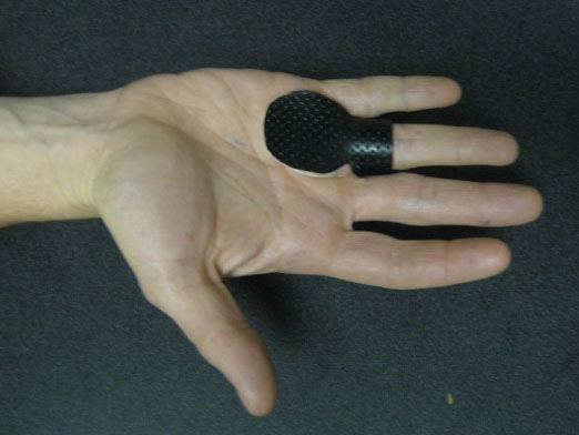 Trigger Finger Thumb Certified Hand Therapist In Burnaby BC Canada
